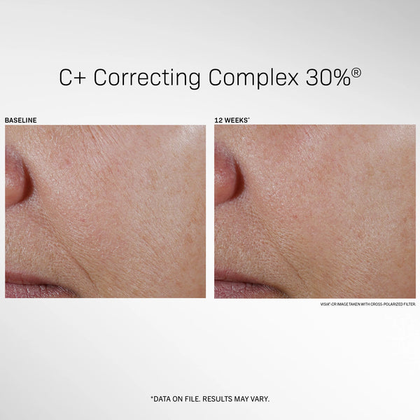 Revision C+ Correcting Complex 30%® 1 FL OZ – Four Seasons OBGYN